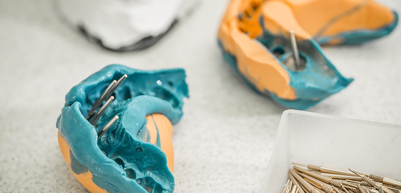 HOW TO ACHIEVE BEST RESULTS WITH A DENTAL IMPLANT IMPRESSION